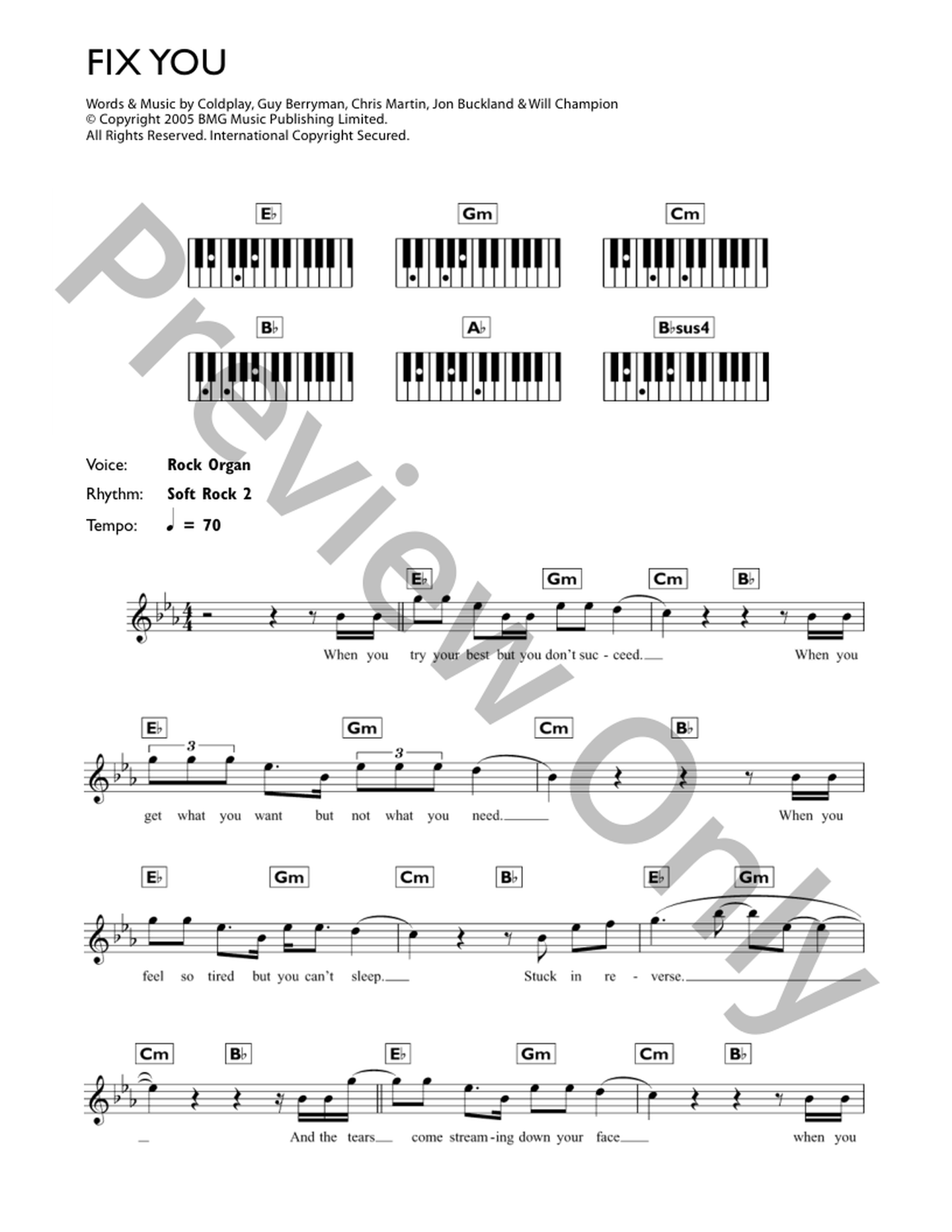 Fix You | J.W. Pepper